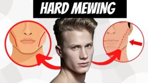 Hard Mewing là gì? Hiểu và hướng dẫn tập luyện đúng cách