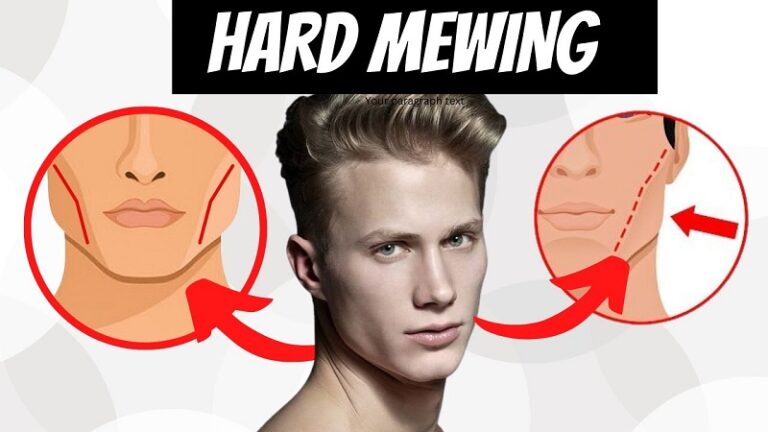 Hard Mewing là gì? Hiểu và hướng dẫn tập luyện đúng cách