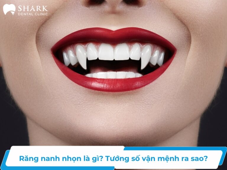 Răng nanh nhọn là gì? Tướng số vận mệnh ra sao?